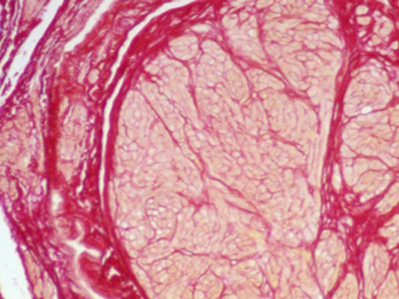 Picro Sirius Red Stain Kit Clinisciences